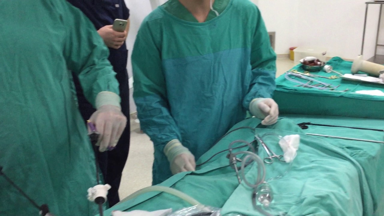 Laparoscopic Appendectomy Scar