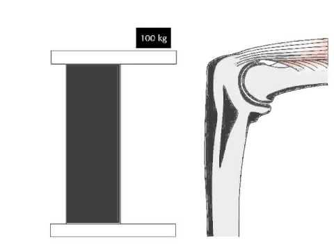 Tension Band Principle Animation - YouTube