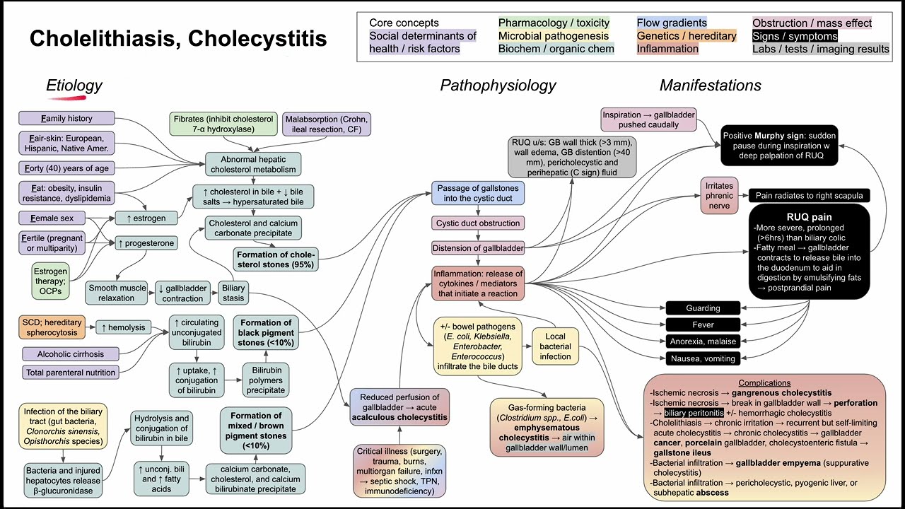 Cholelithiasis Pathophysiology