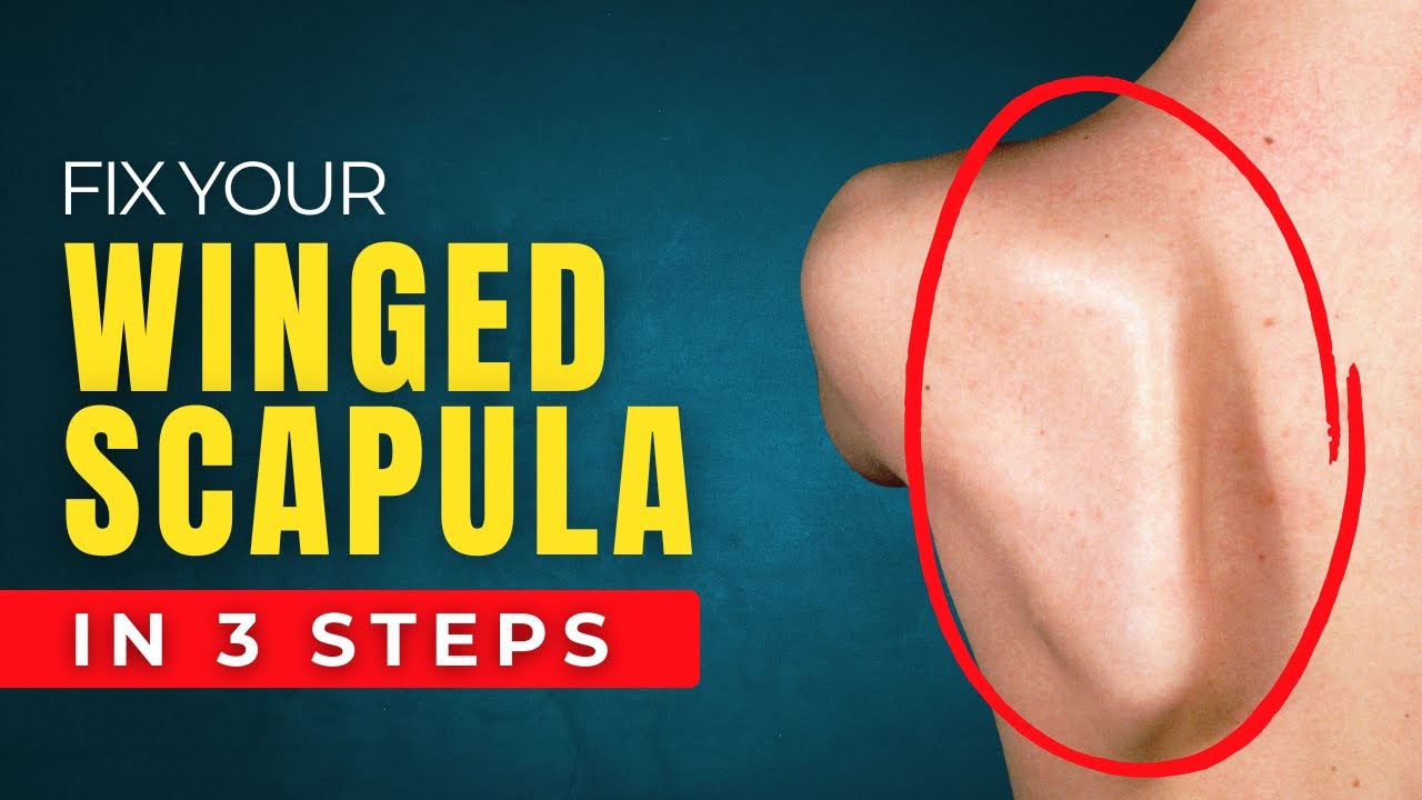 You Can’t Fix Scapula Winging Until You Fix THIS First - YouTube
