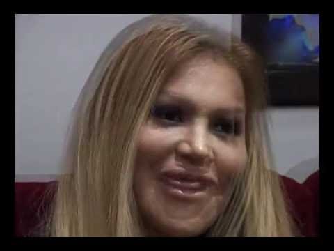 Reqsane qeza toretdi