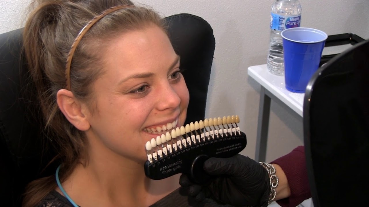 Royal Smiles: Milwaukee's Premier Teeth Whitening Service - YouTube