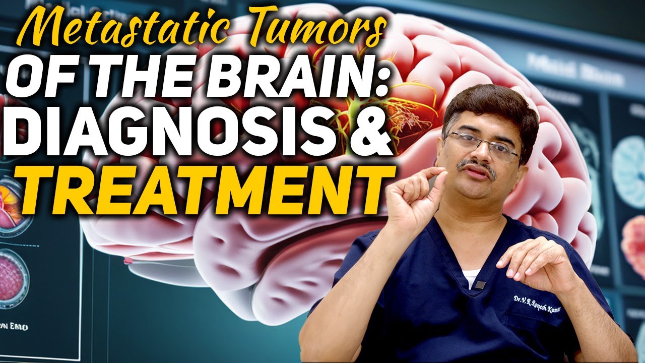 Metastatic Tumors of the Brain: Diagnosis and Treatment Dr.Roopesh ...