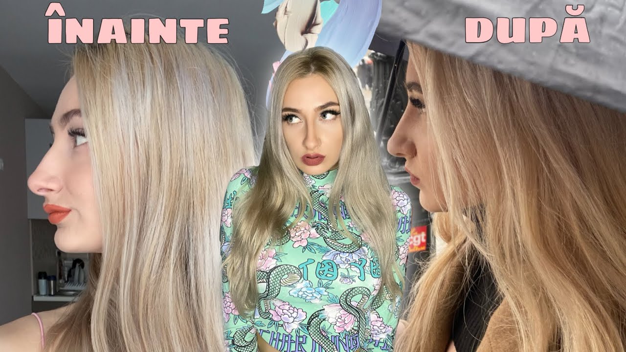 OPERATIE BIMAX | DE CE MI-AM OPERAT FATA? - YouTube