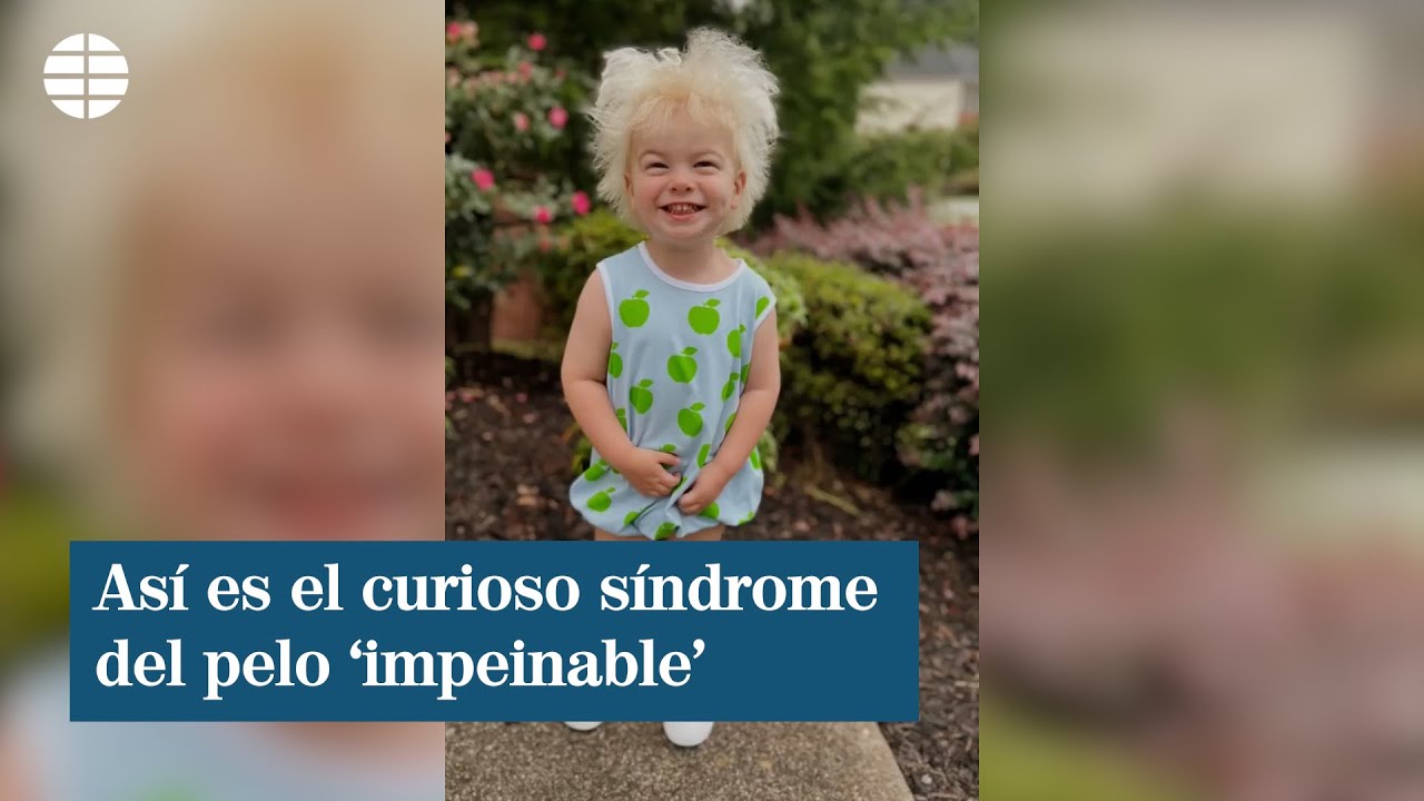 Así es el curioso síndrome del pelo 'impeinable' - YouTube