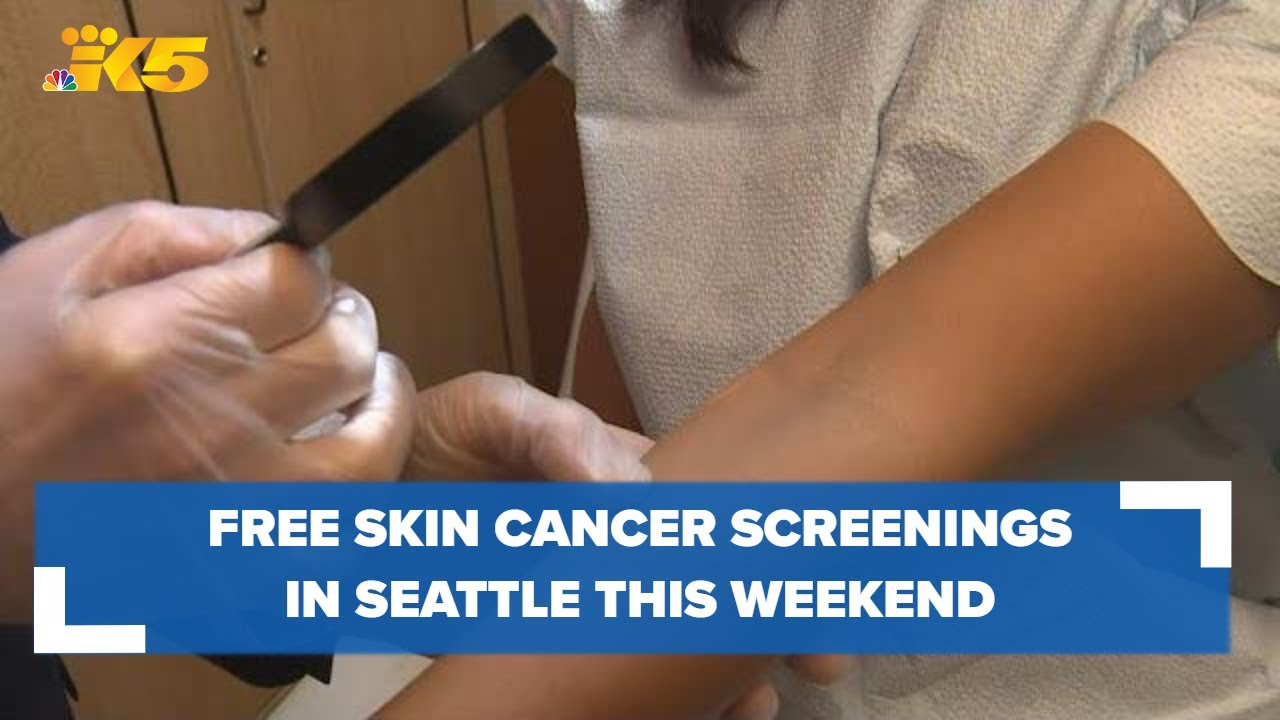 Free skin cancer screenings in Seattle this weekend amid rising ...