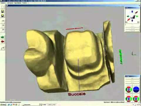 Cerec 3D Sirona Training Video - YouTube