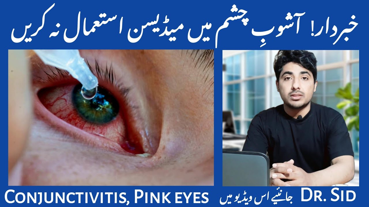 Best natural Pink eyes آشوبِ چشم (Conjunctivitis) remedy, No medication ...