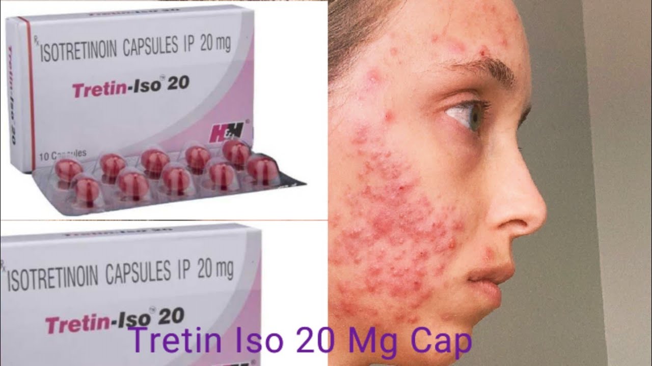 Tretin Iso 20 Mg Capsule Review In Hindi - YouTube