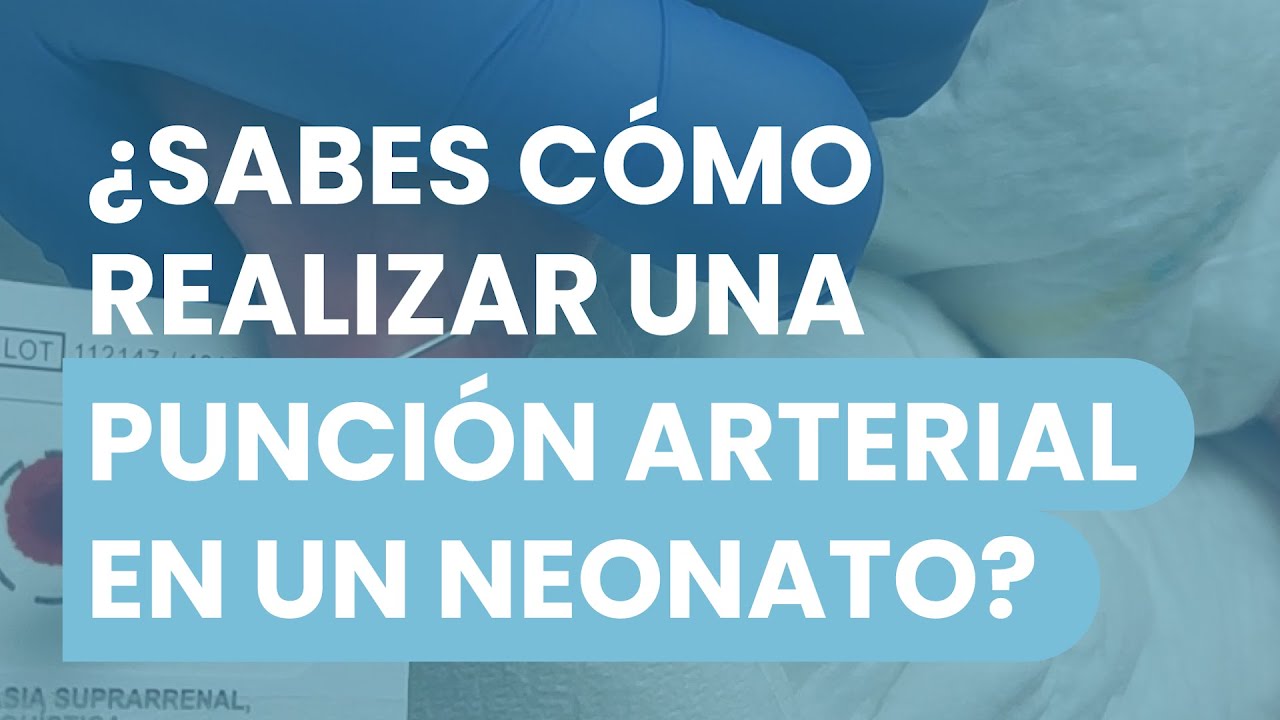 👶🩸 ¿Sabes cómo realizar una Punción arterial en un Neonato? 👶🩸 ...