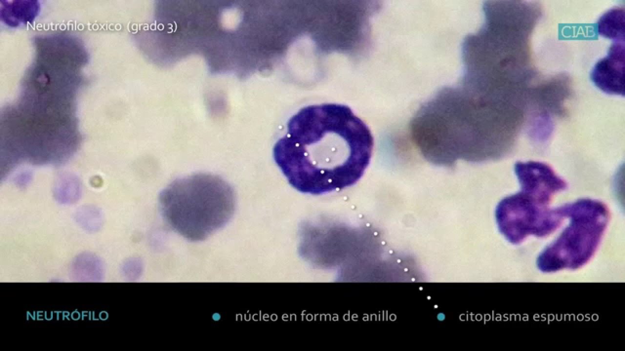 Neutrófilo en forma de anillo. CIAB www.ciab.es - YouTube