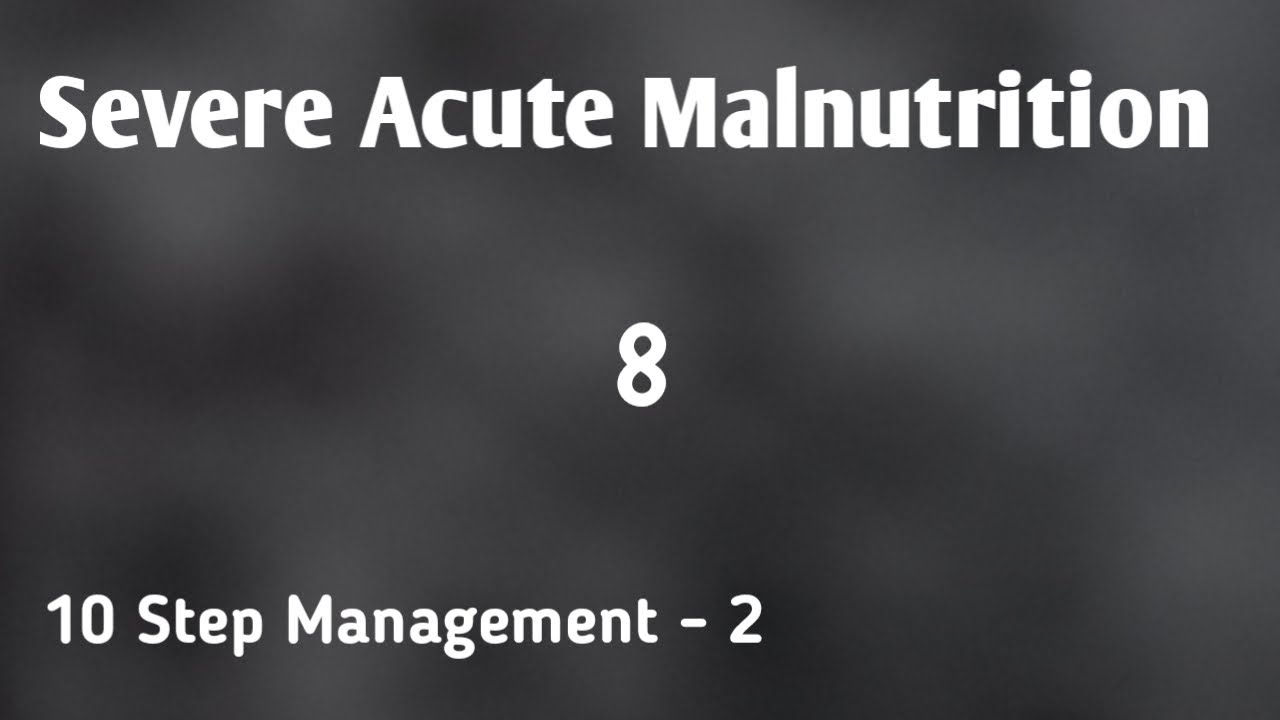 10 Step Management of SAM - 2 - YouTube