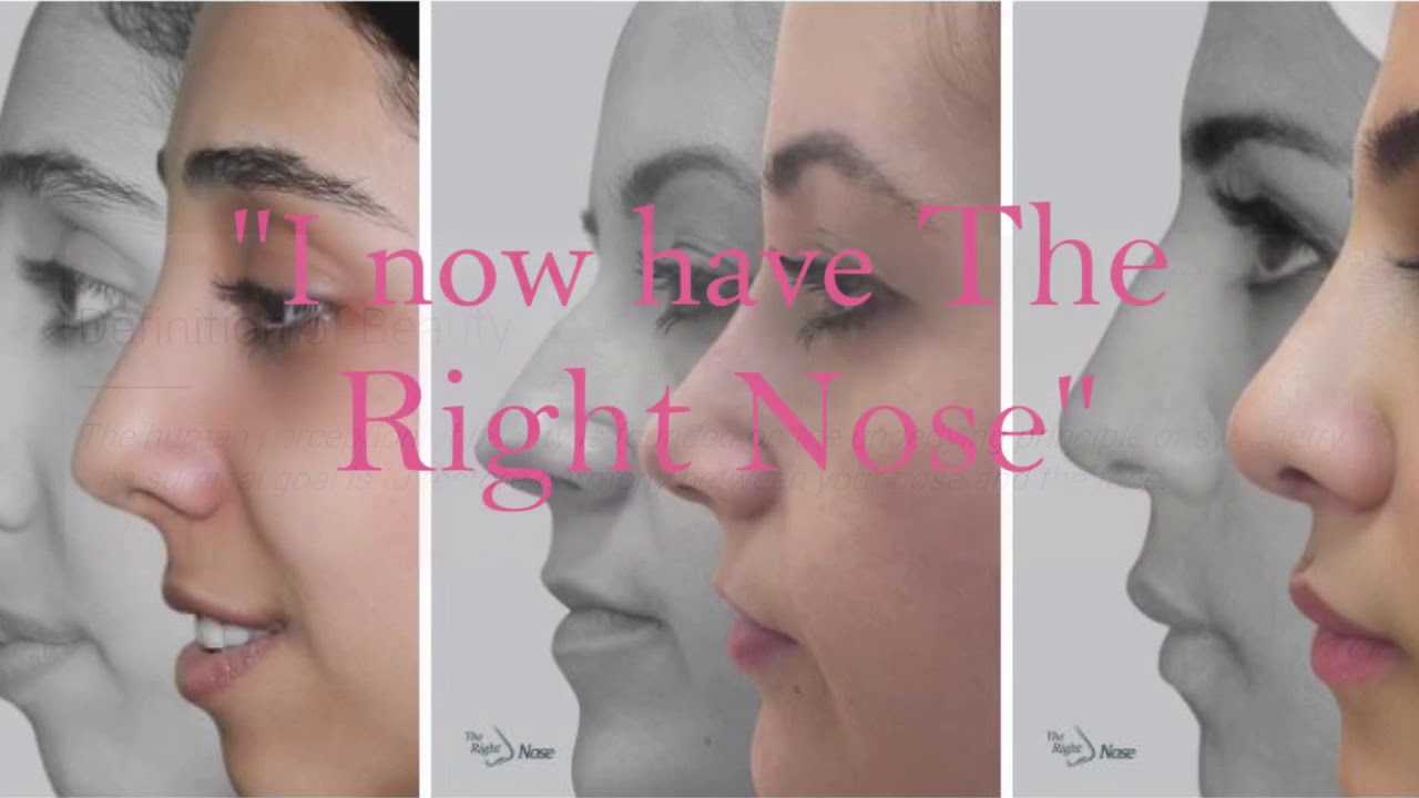 The Right Nose Clinic - The best nose jobs in Dubai - YouTube