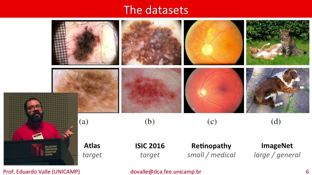 Knowledge Transfer for Melanoma Screening with Deep Learning - YouTube