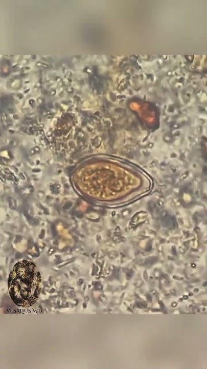 Huevo de Trichuris trichiura - YouTube