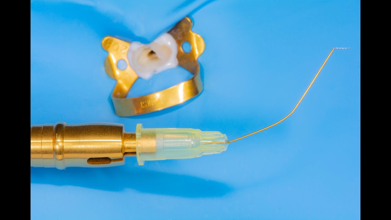 Broken File Removal with BTR Pen Gold Edition - YouTube