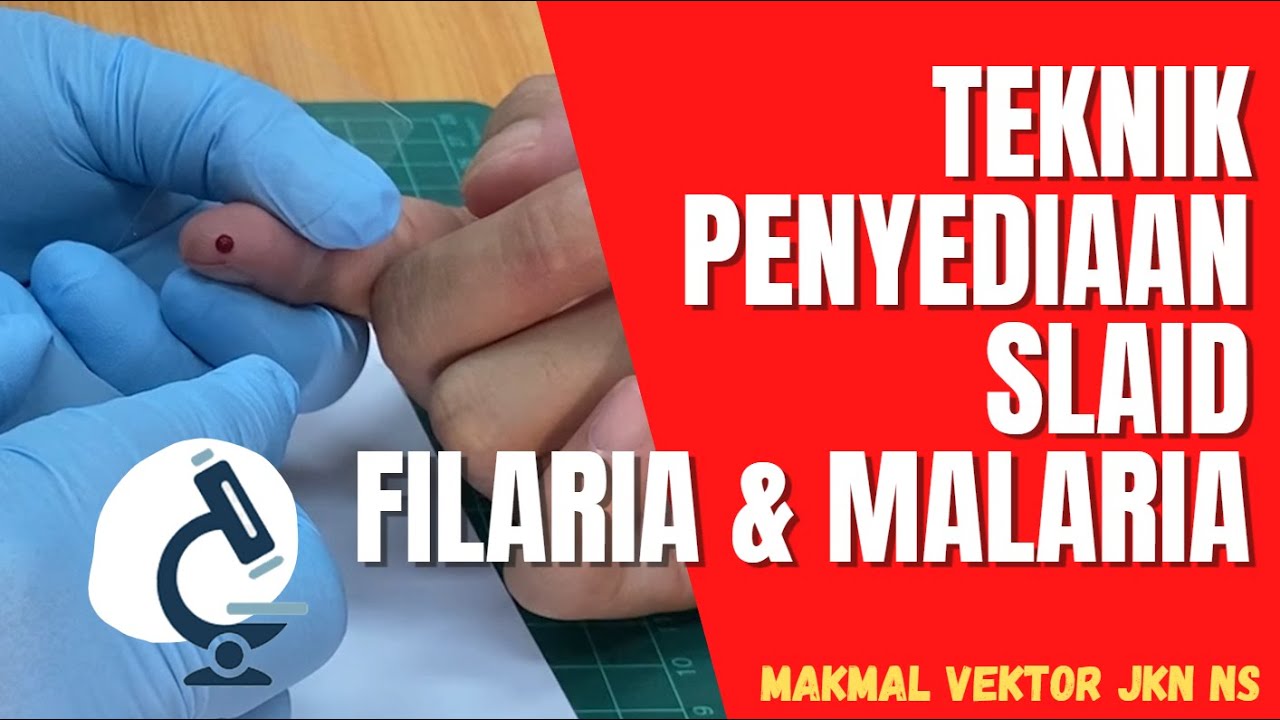 HOW TO MAKE THIN & THICK BLOOD SMEAR FOR BFMP & FILARIASIS (PENYEDIAAN ...