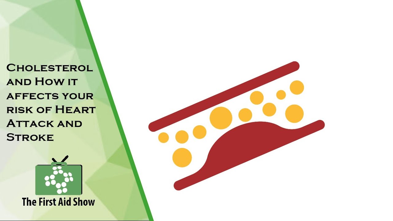 Cholesterol and How it affects your risk of Heart Attack and Stroke ...