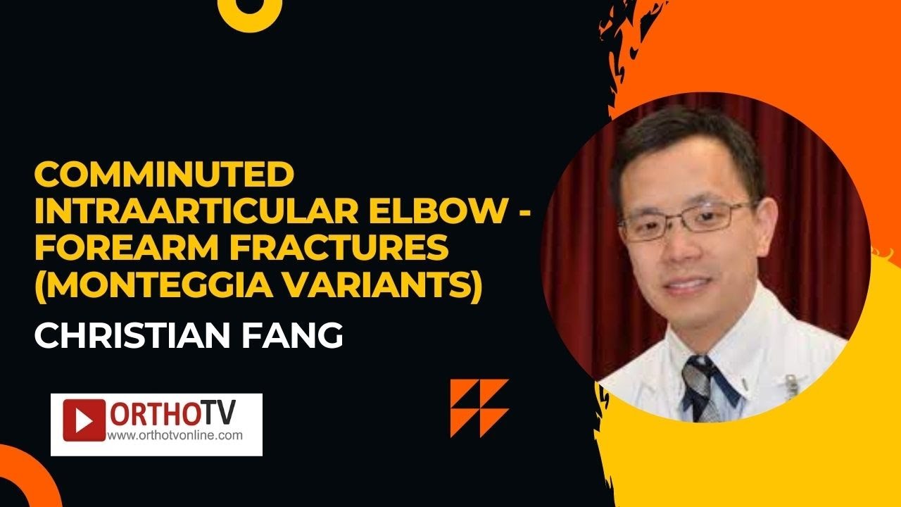 Comminuted Intraarticular Elbow - Forearm fractures (Monteggia Variants ...