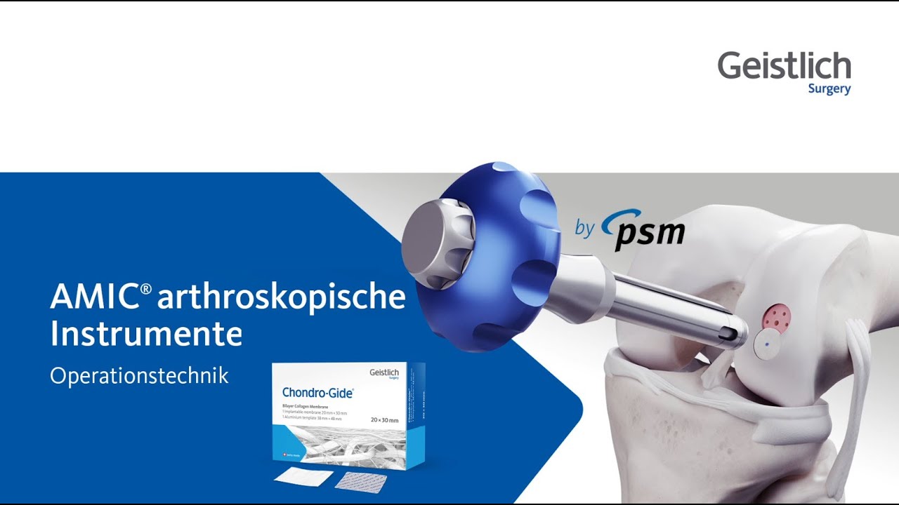 AMIC® arthroskopische Instrumente - Operationstechnik - YouTube