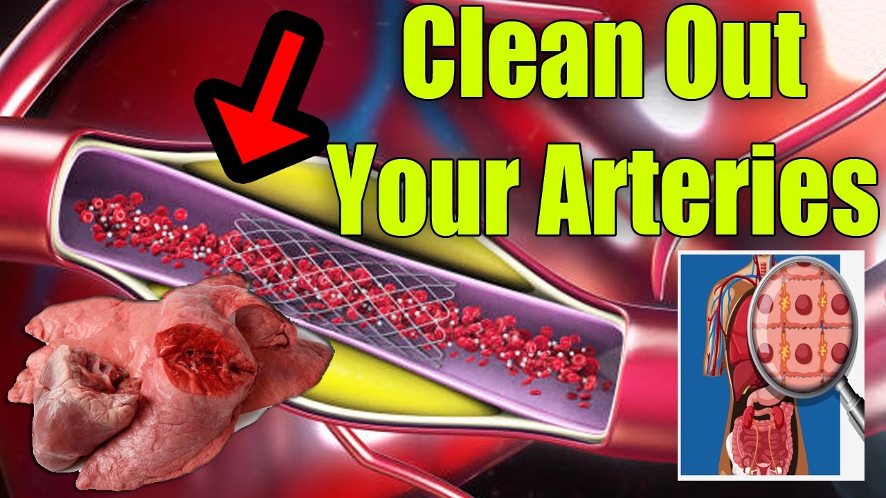 Clean Out Your Arteries and Veins With 6 Super Foods! Best Foods to ...