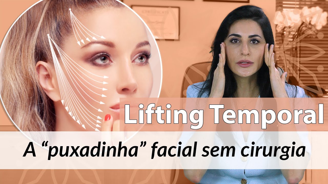 Lifting Temporal - A técnica de levantamento do rosto sem cirurgia ...