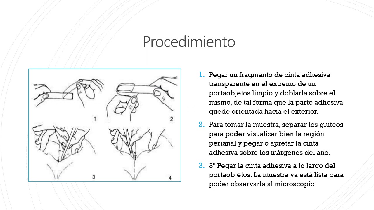 Técnica de Graham - YouTube