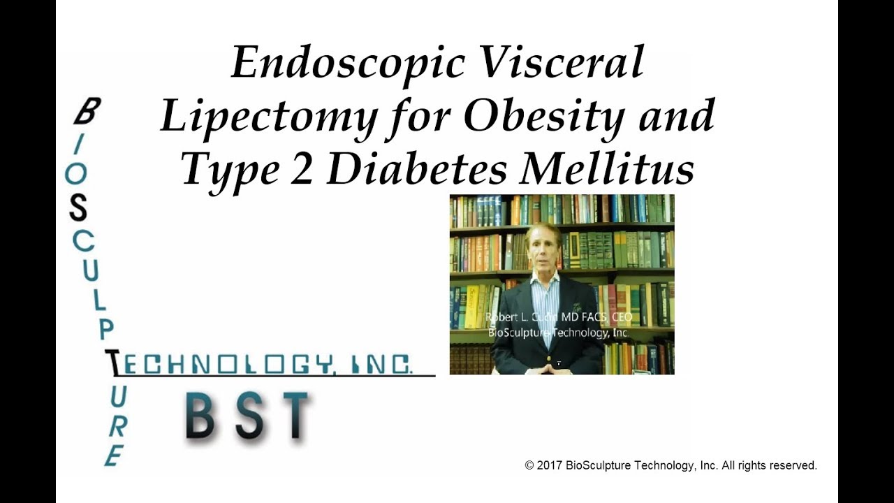 BioSculpture Technology, Inc.'s Endoscopic Visceral Lipectomy Project ...