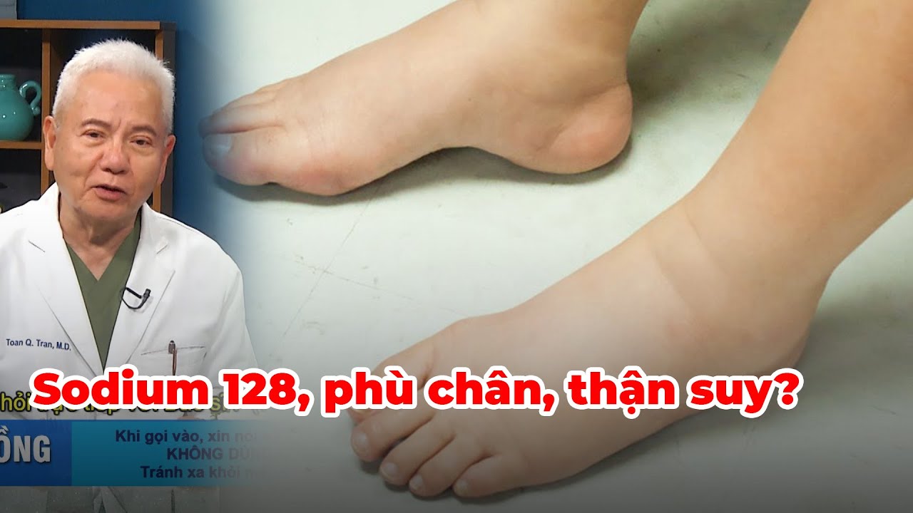 Y Tế Cộng Đồng Phần 1 (08/30/2022) Sodium 128, phù chân, thận suy ...