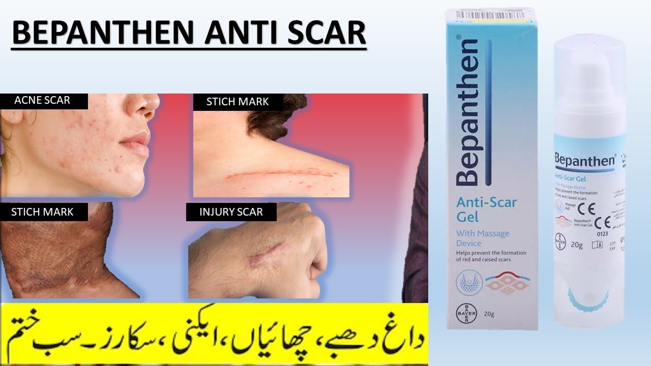 Bepanthen anti scar cream | contratubex alternative cream | wound scar ...