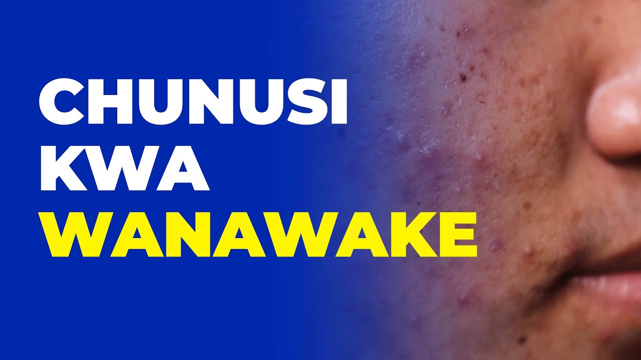 Chunusi nyingi usoni. je wajua chunusi nyingi kwa mwanamke huwa ...