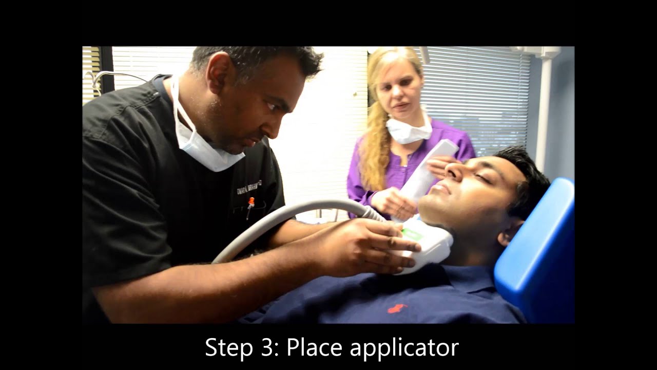 Watch CoolSculpting Mini Application for Double Chin. Freeze Fat. - YouTube