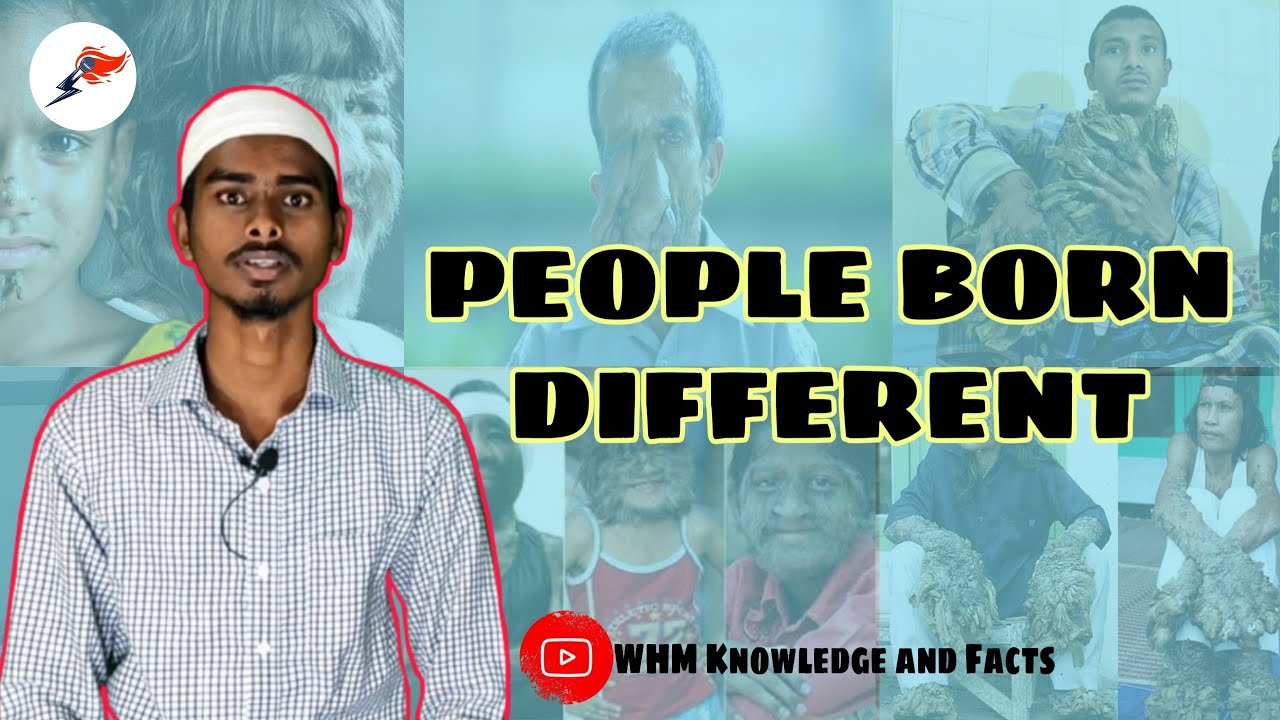 PEOPLE BORN DIFFERENT|| Unique people in the world || WHM Knowledge and ...