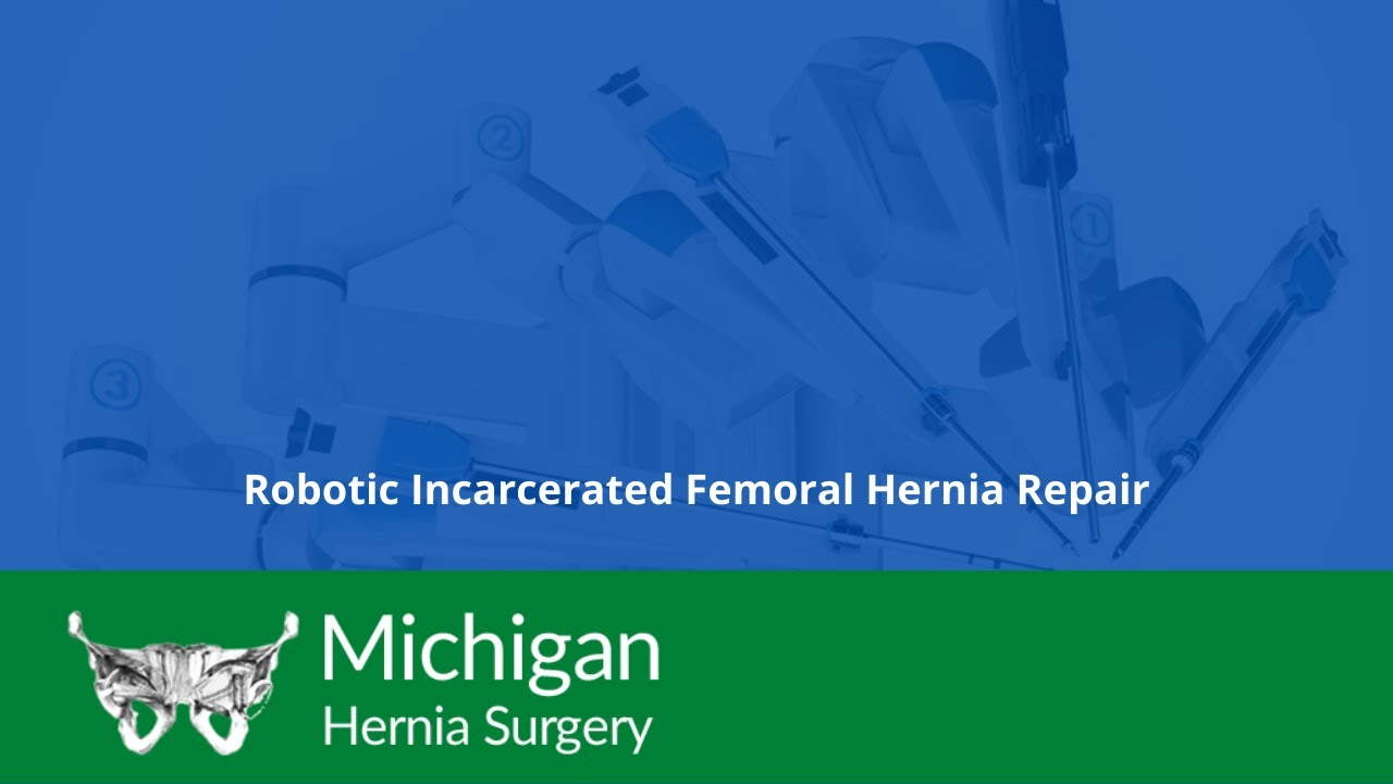 Robotic Incarcerated Femoral Hernia Repair | Michigan Hernia Surgery ...
