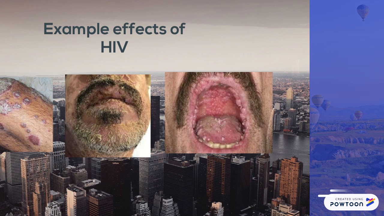 HIV VIDEO PROJECT - YouTube