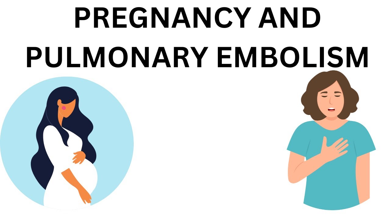 PULMONARY EMBOLISM IN PREGNANCY | ITS MANAGEMENT | MEDICINE HANDY ...