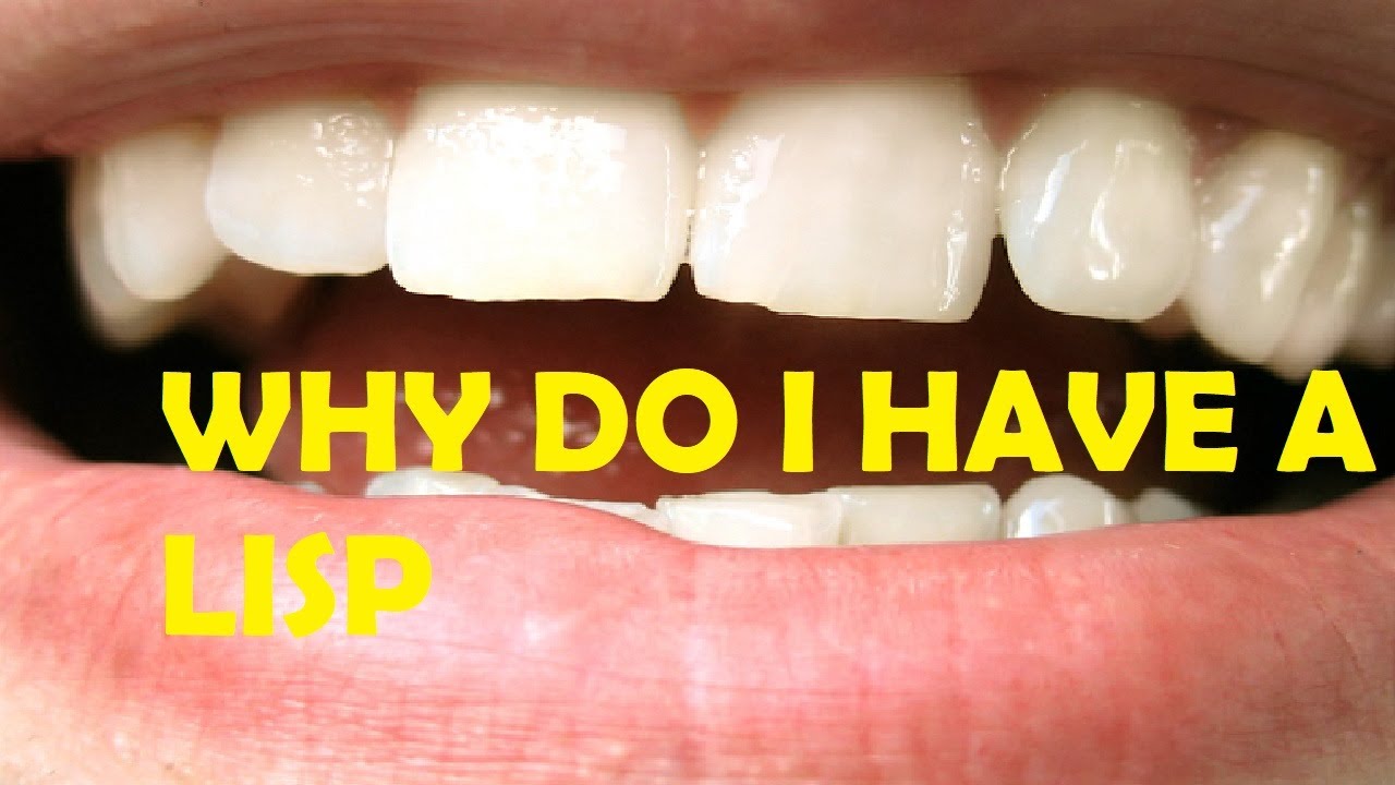why do I have a lisp - YouTube