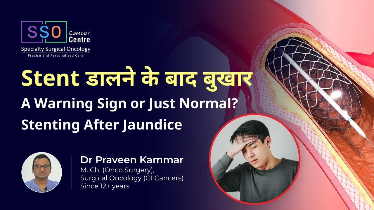 Stent डालने के बाद बुखार: A Warning Sign or Just Normal? | Stenting ...