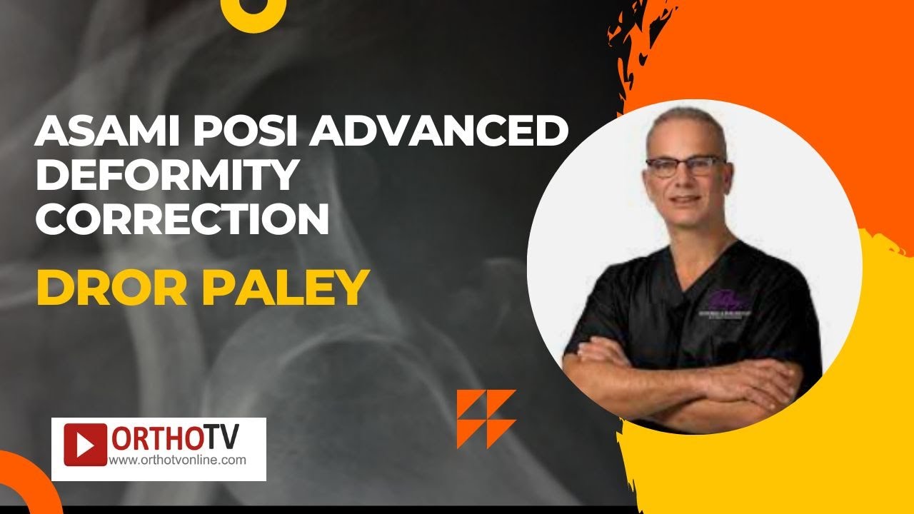ASAMI POSI Advanced deformity correction webinar Dror Paley - YouTube