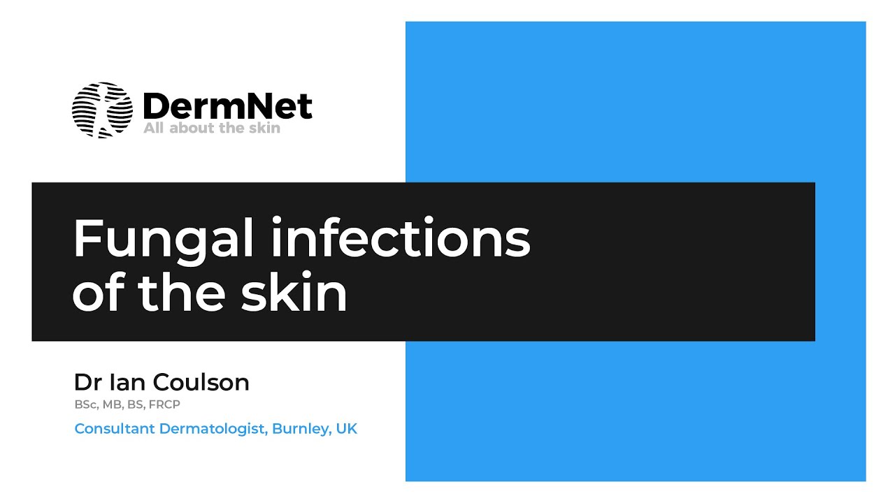 Fungal infections of the skin - YouTube
