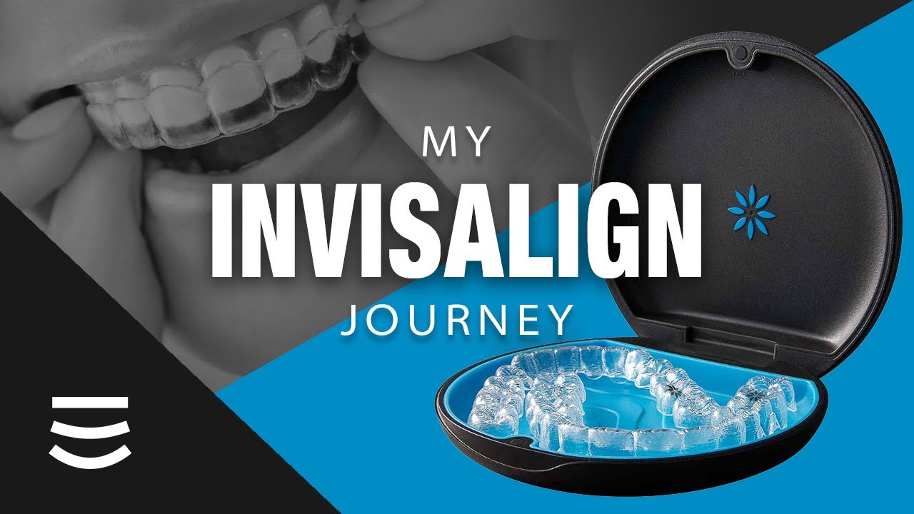 All About Invisalign | Stanley Dentistry - YouTube