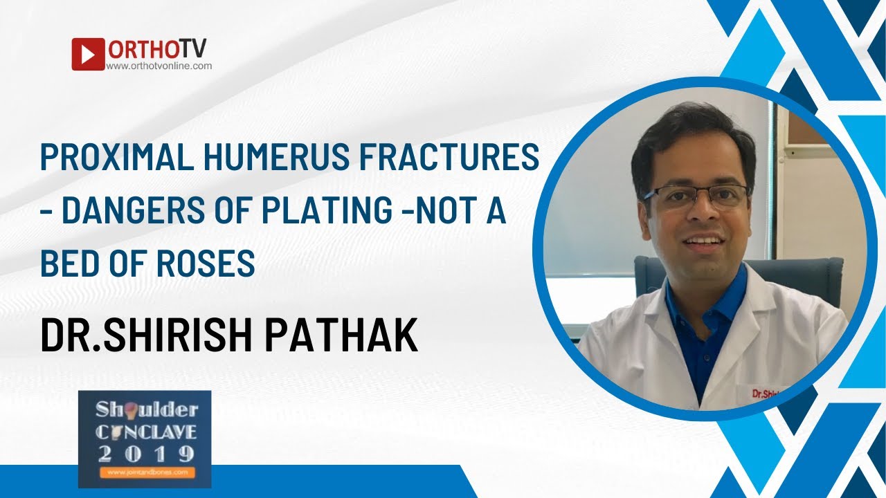 Proximal humerus fractures - dangers of Plating -Not a bed of roses ...
