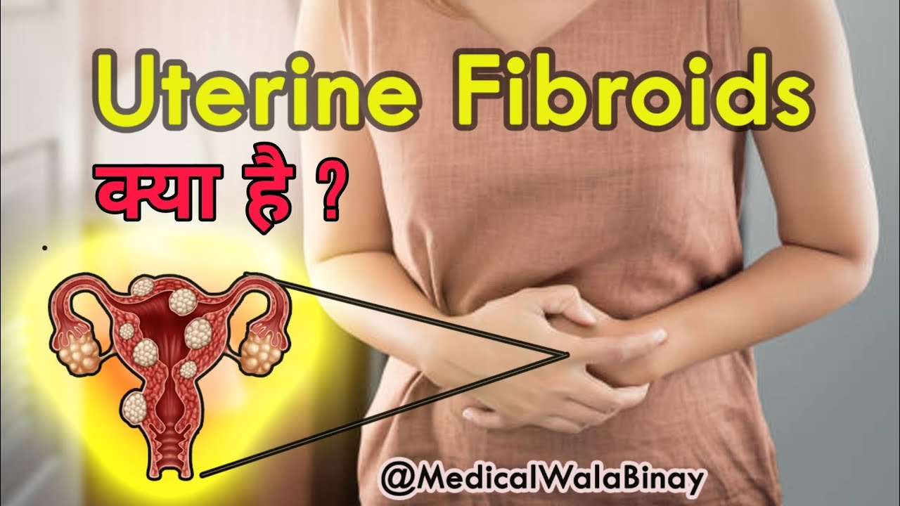 uterine fibroidsक्या होता है।अल्ट्रासाउंड report में fibroids को कैसे ...