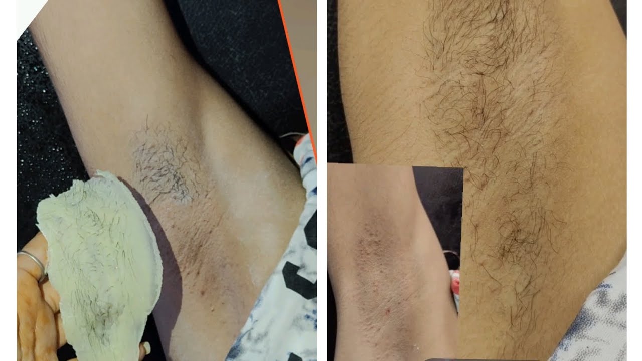 Clear Armpit with Easy tricks // Armpit/under arms waxing //Under arms ...