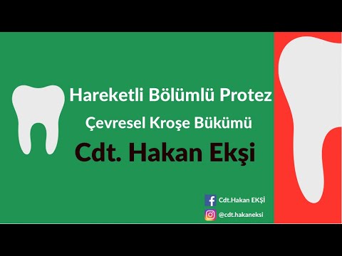 Hareketli Bölümlü Protez Çevresel Kroşe Bükümü #bölümlüprotez #protez