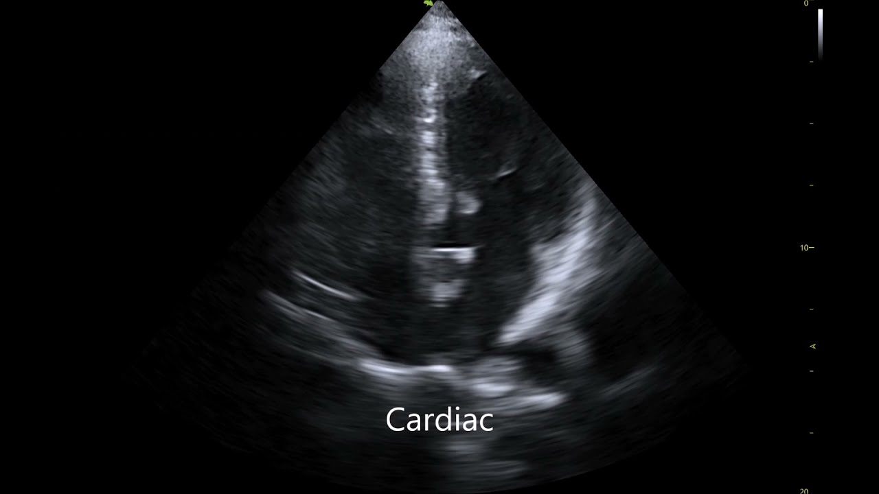 Q series clinical images - YouTube