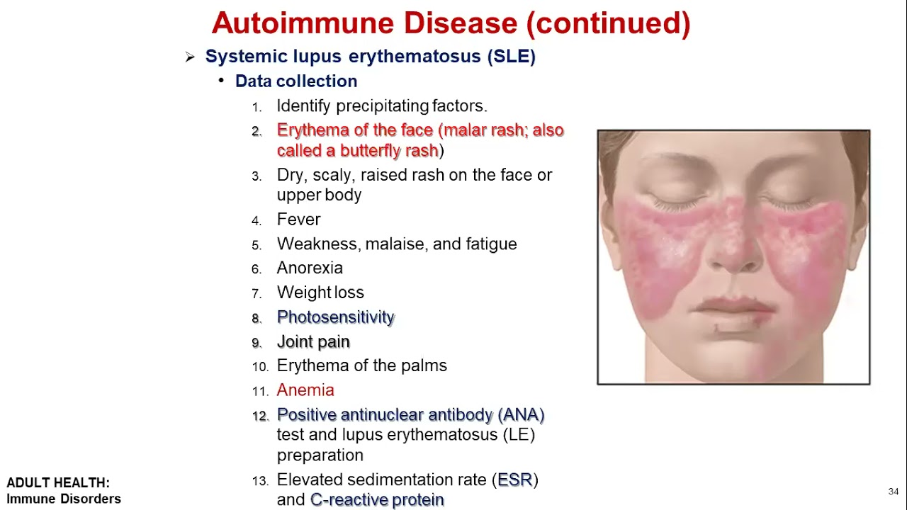 Autoimmune Disease Systemic Lupus Erythematosus (SLE) - Med-Surg NCLEX ...