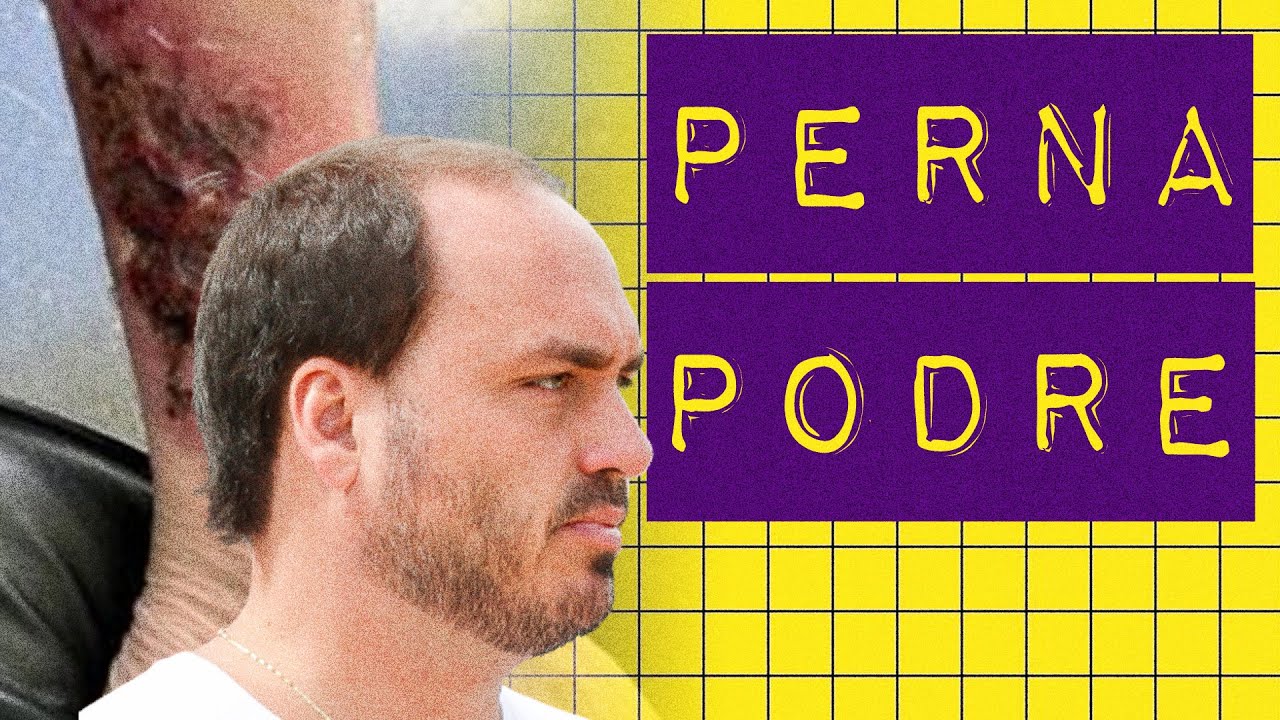 PEREBA DE BOLSONARO É MOSTRADA POR CARLOS - YouTube