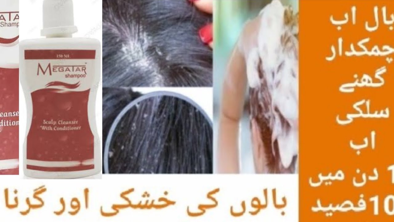 Megatar shampoo uses in urdu l best for itching and irritation and hair ...