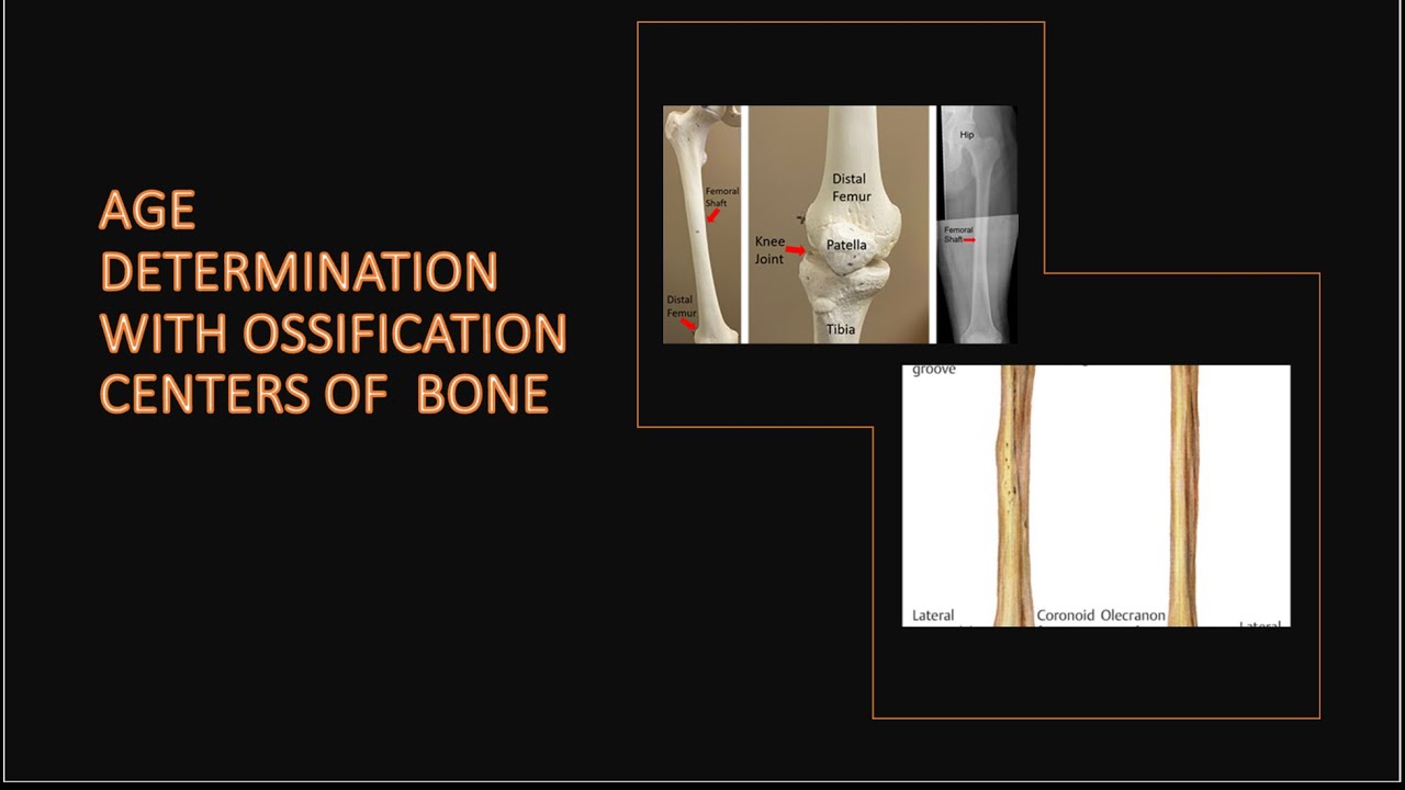 AGE DETERMINATION WITH OSSIFICATION CENTRES OF BONES - YouTube